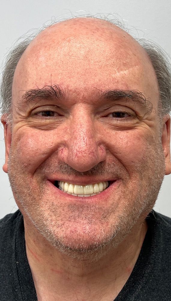 Family & Implant Dentist in Colorado Springs, CO | North End Dental