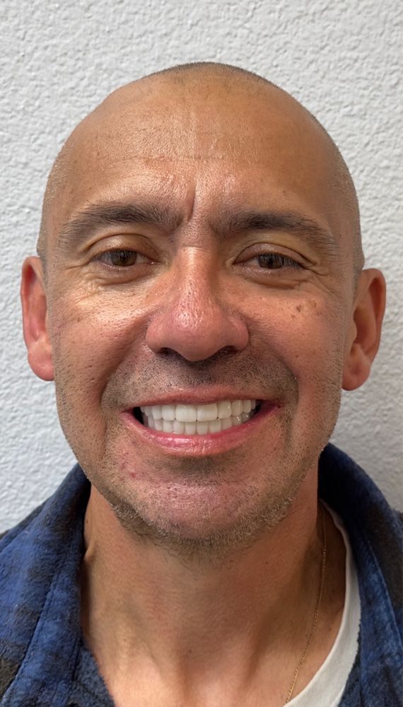 Family & Implant Dentist in Colorado Springs, CO | North End Dental